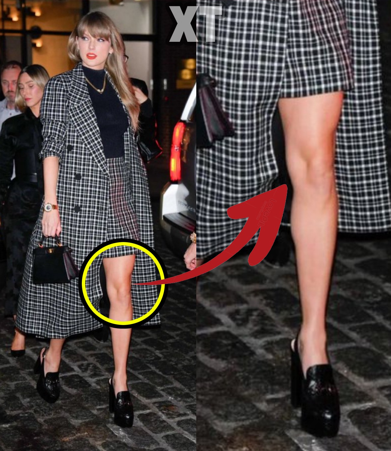 PHOTOS: Taylor Swift Had Everyone Going Crazy Over Her Insane Thigh ...