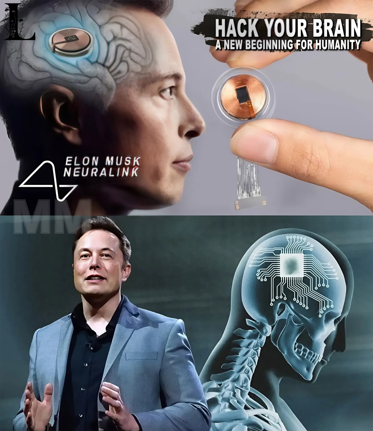 NEURALINK New Update! Elon Musk Rev3als The Truth After Second Trial! - News